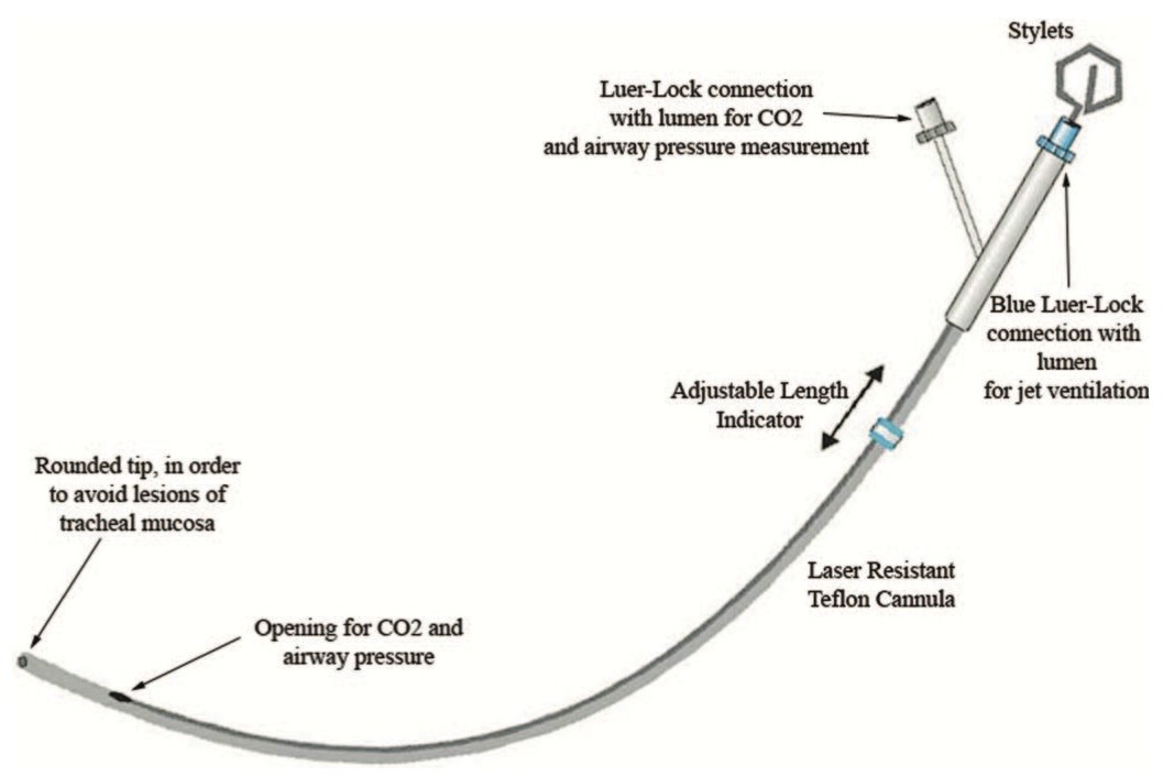 High Frequency Jet Ventilation – Heart Rhythm Center