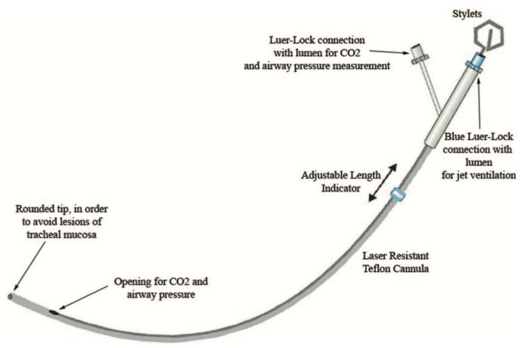 High Frequency Jet Ventilation During Ablation of Supraventricular and ...